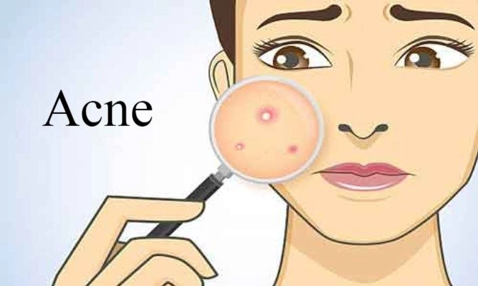 Proven Skin Benefits of Eating Tilapia Fish Regularly